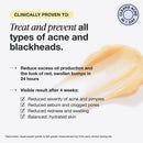 Acne Treatment Serum | Clears Breakouts & Blackheads – INNBEAUTY PROJECT