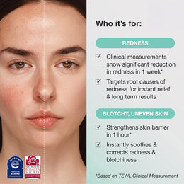 Calm The Red Down | Redness Relief Serum for Sensitive Skin – INNBEAUTY ...