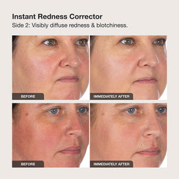 Calm The Red Down | Soothing Serum for Redness & Irritation – INNBEAUTY ...