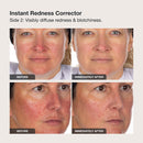 Calm The Red Down | Soothing Serum for Redness & Irritation – INNBEAUTY ...