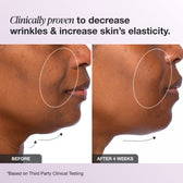 Elastic Skin Anti-Aging Serum | Growth Factors & Peptides for Firmness ...