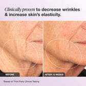 Elastic Skin Anti-Aging Serum | Growth Factors & Peptides for Firmness ...