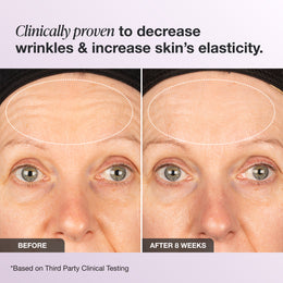 Elastic Skin Anti-Aging Serum | Growth Factors & Peptides for Firmness ...