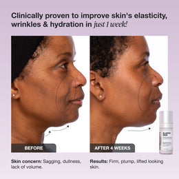 Elastic Skin – INNBEAUTY PROJECT