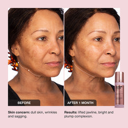 Extreme Cream Refillable Moisturizer | Firming & Lifting Skincare ...